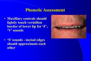 Setting Maxillary Anterior Teeth for aesthetics and phonetics.ppt