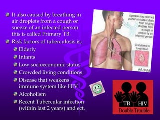 14 .pulmonarytuberculosis.ppt MEDICAL studies | PPT