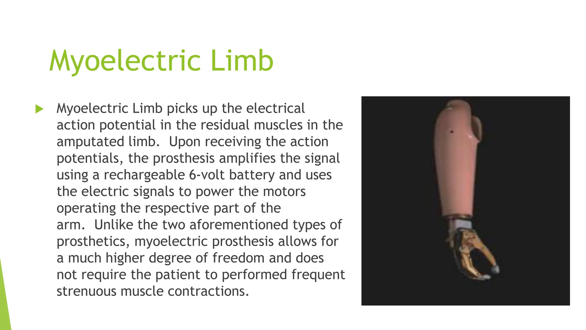 14. Rehabilitation of Adults with Upper-Limb Amputations nimra jamshaid ...