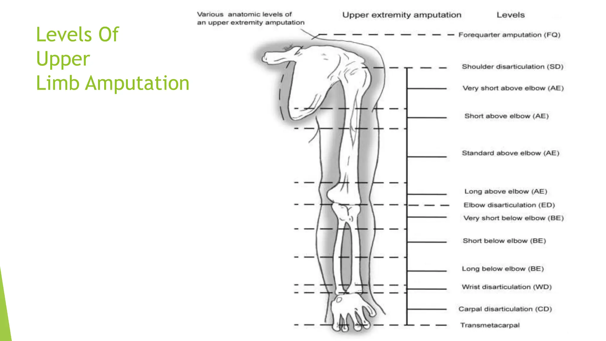 14. Rehabilitation of Adults with Upper-Limb Amputations nimra jamshaid.pptx | Physical Therapy ...