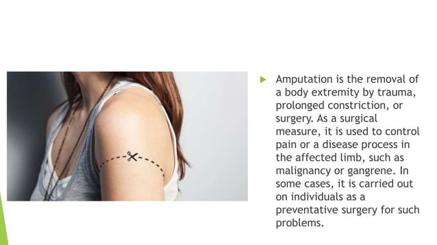 14. Rehabilitation of Adults with Upper-Limb Amputations nimra jamshaid.pptx