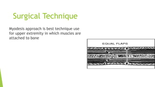 14. Rehabilitation of Adults with Upper-Limb Amputations nimra jamshaid ...