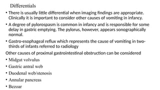 14. Hypertrophic Pyloric Stenosis. pptx | PPT