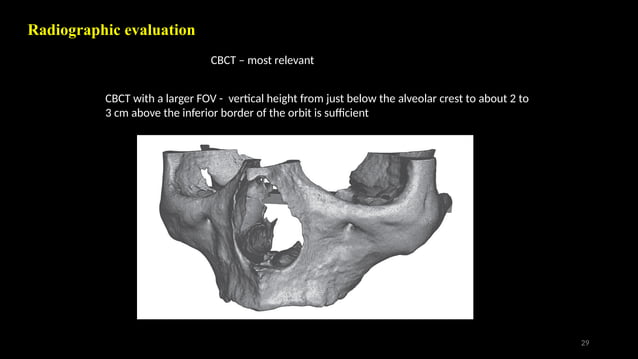 ZAGA (Zygoma Anatomy Guided Approach) Technique | PPTX