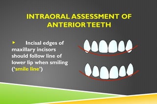 14. Set Anterior Teeth in prosthodontics.pptx