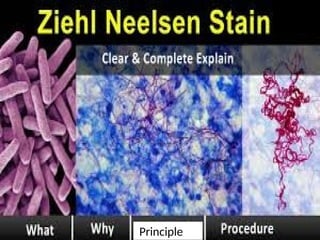 14. Acid fast staining Theory and Demo.ppt