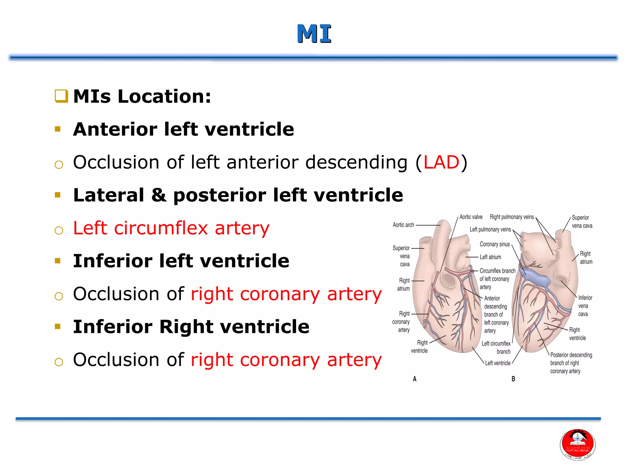 14- Acute Myocardial Infarction.pdf