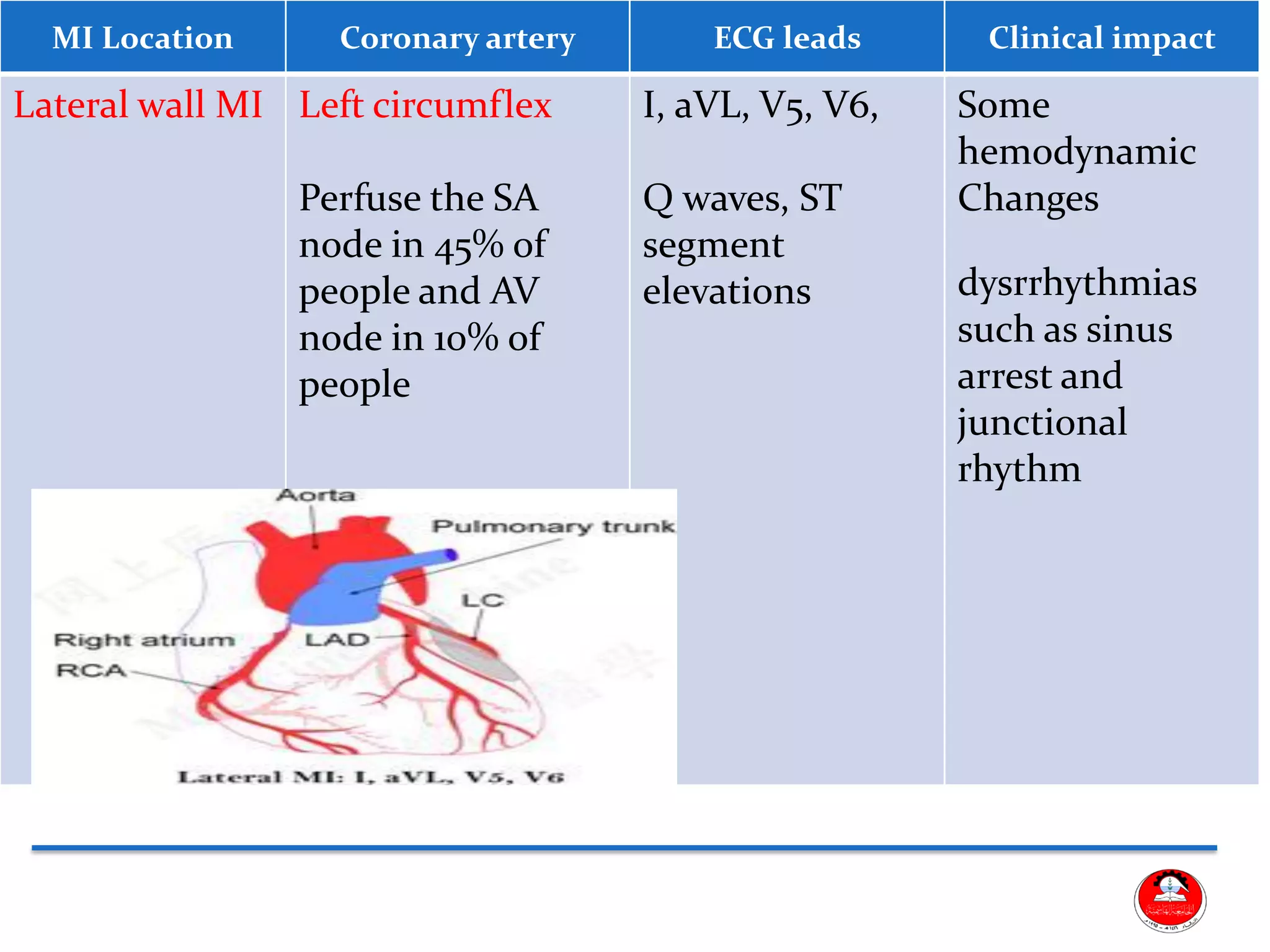 14- Acute Myocardial Infarction.pdf