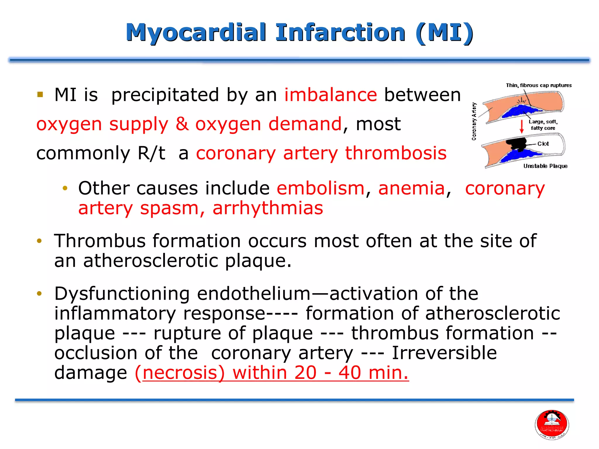 14- Acute Myocardial Infarction.pdf