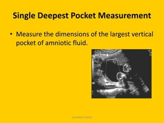 14-amniotic fluid imaging Dr Ahmed Esawy | PPT