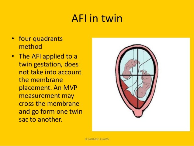 Quick Obgyn Amniotic Fluid Index And Its Importance Youtube