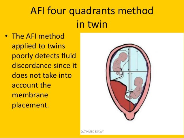 14-amniotic fluid imaging Dr Ahmed Esawy