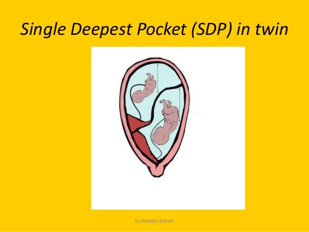 14-amniotic fluid imaging Dr Ahmed Esawy