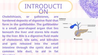 MEDICAL SURGICAL NURSING - Cholelithiasis.pptx
