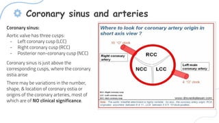 circulation system of coronaries of heart | PDF