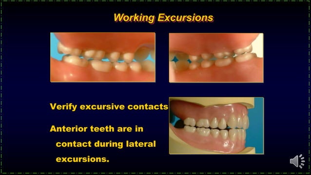 14- Denture Processing and Laboratory Errors.pptx