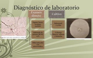 14.geotricosis | PPT