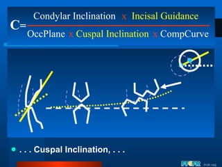 14.hanau's quint | PPT