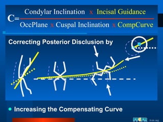 14.hanau's quint | PPT