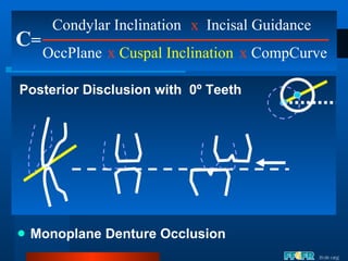 14.hanau's quint | PPT