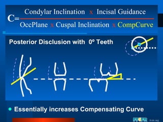 14.hanau's quint | PPT