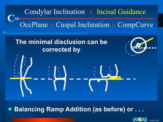 14.hanau's quint | PPT