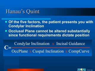 14.hanau's quint | PPT