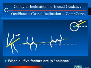 14.hanau's quint | PPT