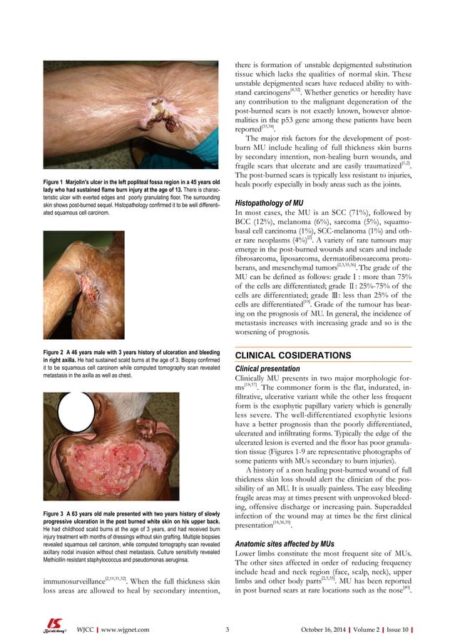 Marjolin's ulcers | PDF | Injuries | Diseases and Conditions