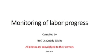 14 monitoring of labor progress 23-4-2018 | PPT