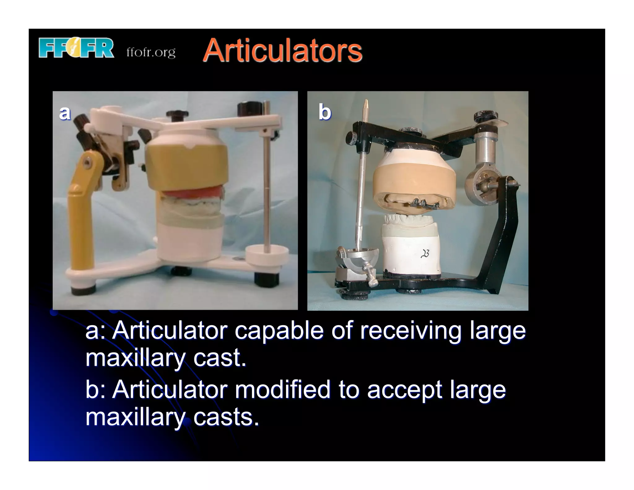 14. (new) definitive obturators edentulous patients | PDF