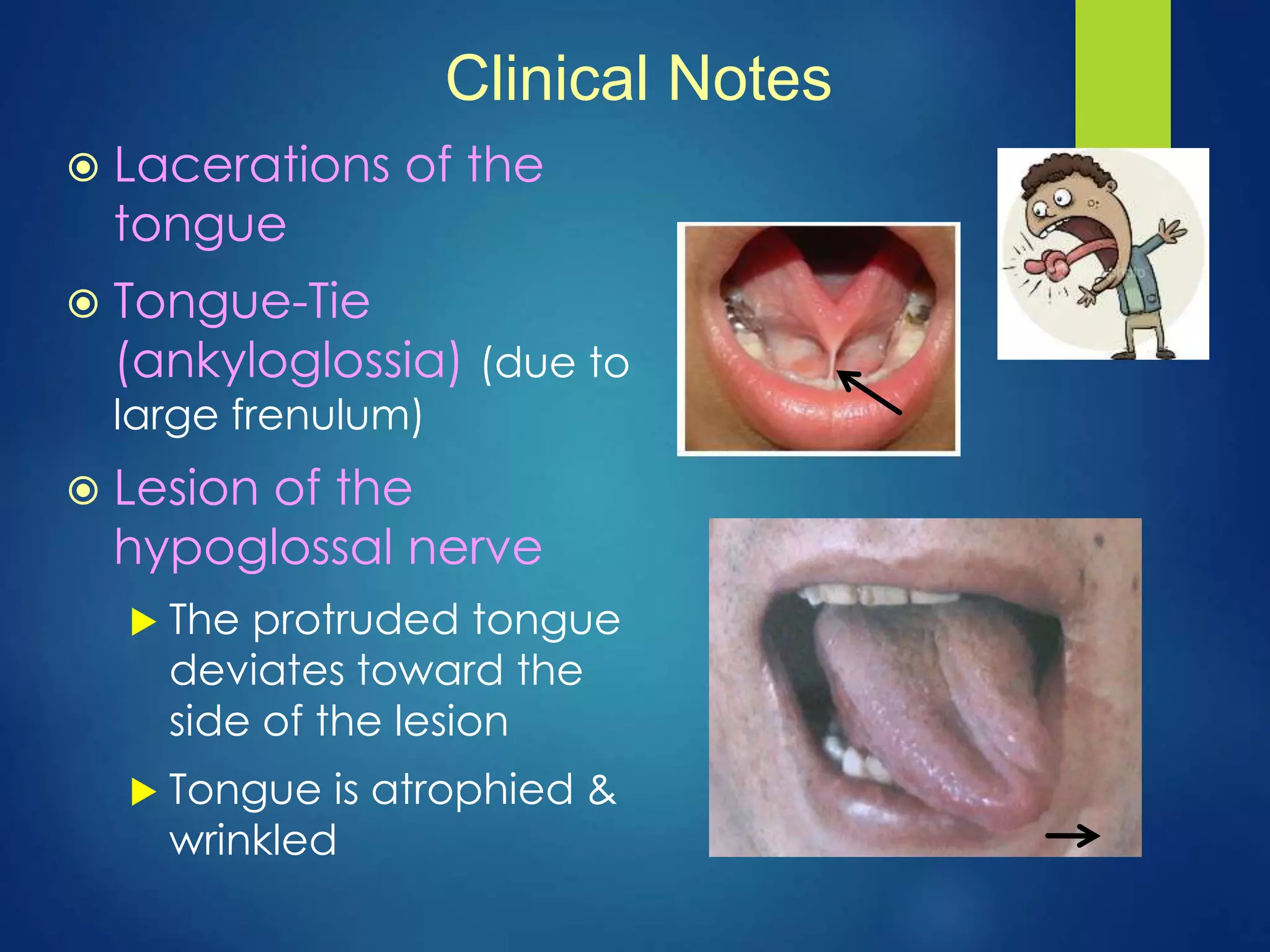 anatomy of oral cavity ,tongue and palate | PPTX