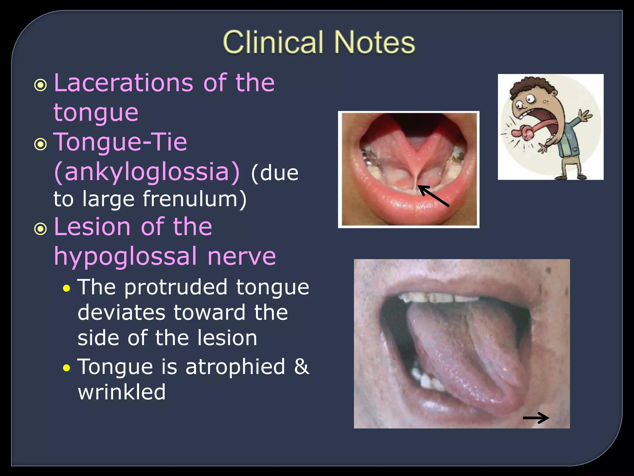 14-ORAL CAVITY.ppt