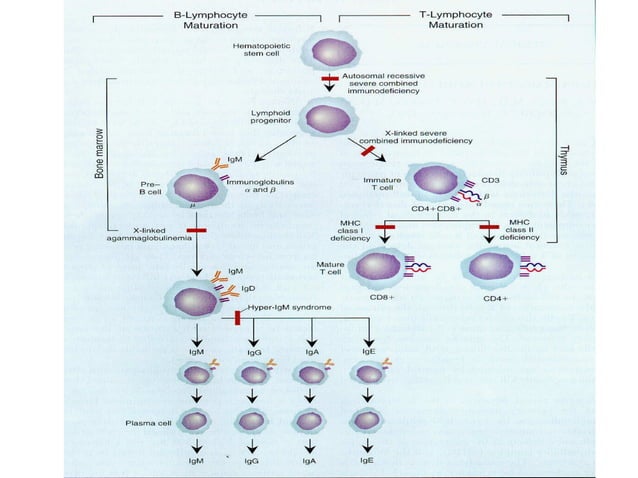 14 Primary Immunodeficiency Diseases | PPT