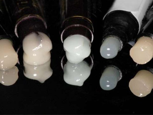 14 resinas compuestas