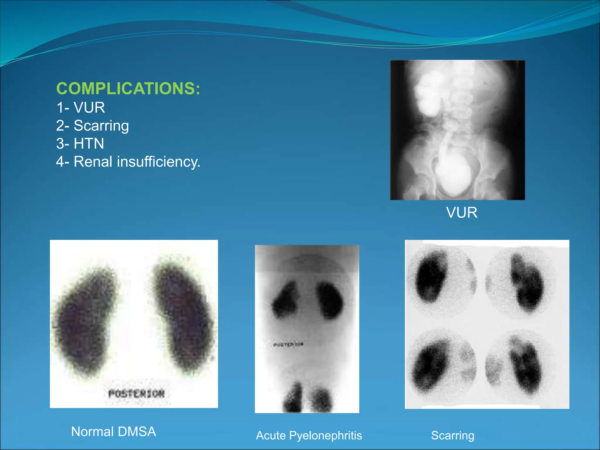 14- UTI IN CHILDREN STUdent and what causes | PPT
