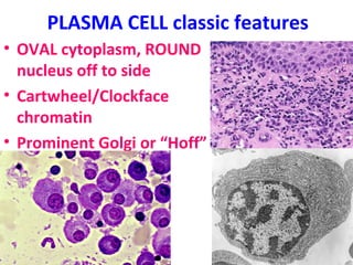 Plasma Cell Clock Face