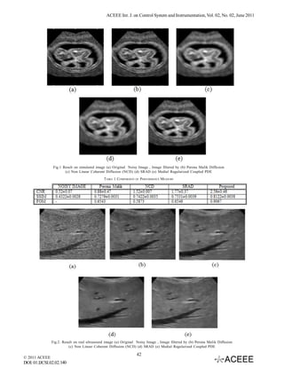 Despeckling of Ultrasound Imaging using Median Regularized Coupled Pde ...