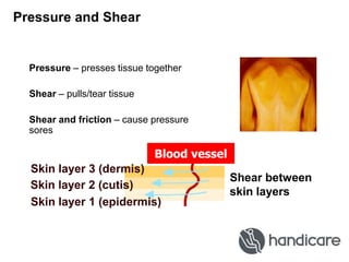 Reducing the incidence of pressure sores and shearing damage for bed ...