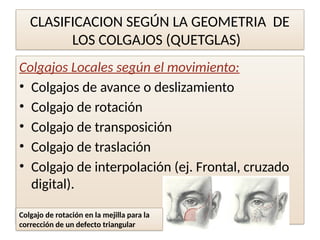 Generalidades de colgajos en cirugía plastica y reconstructiva | PPTX