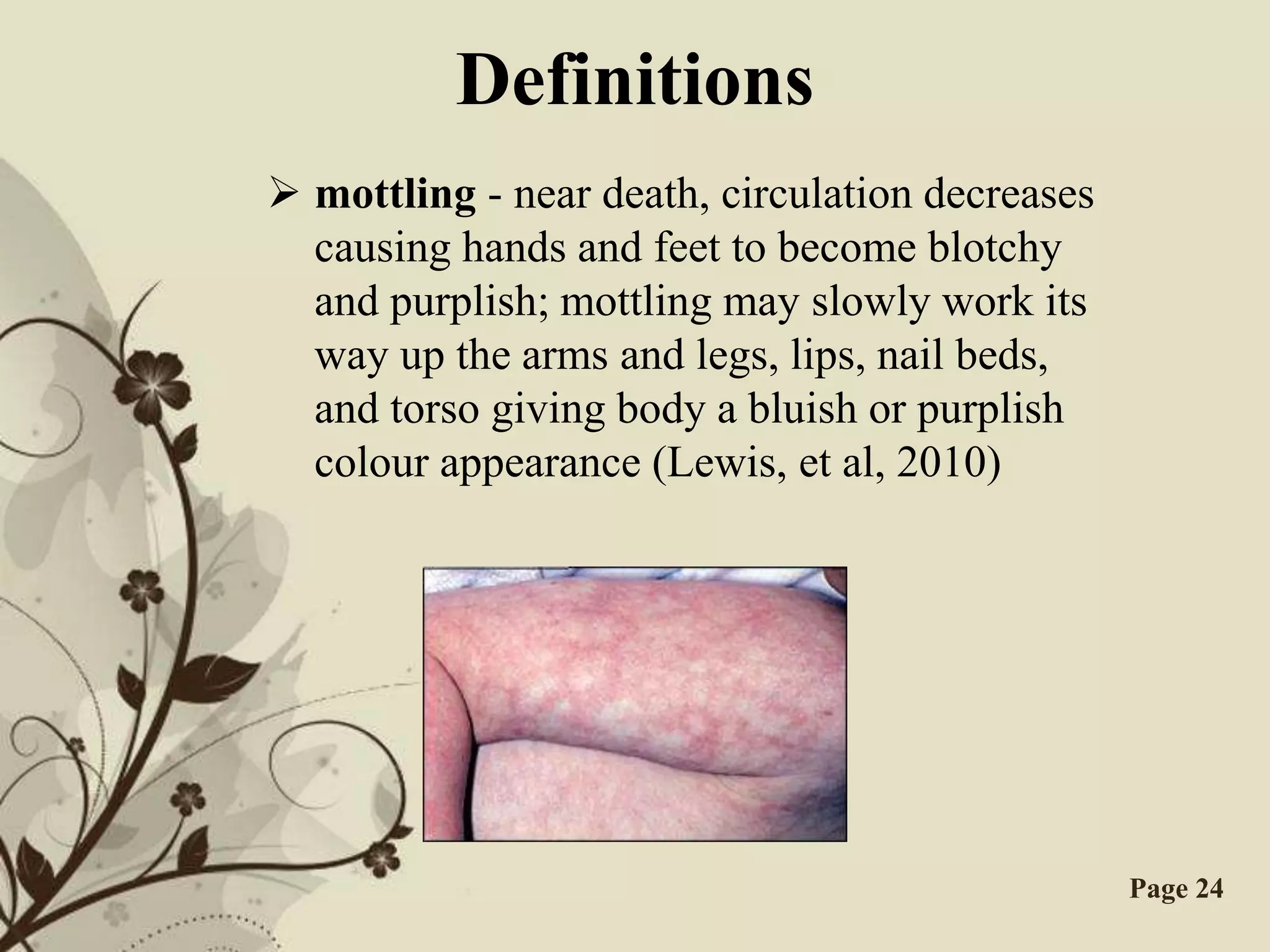 End of Life Presentation | PPTX