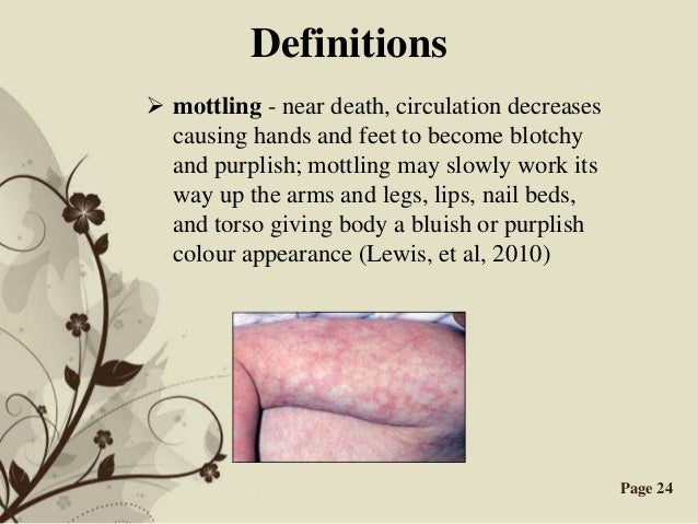 End of Life Presentation