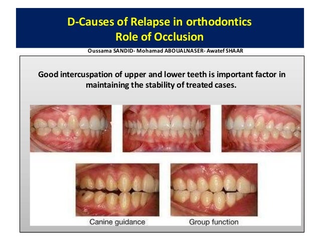 141 relapse in orthodontics-recidives en orthodontie-oussama sandid-m…