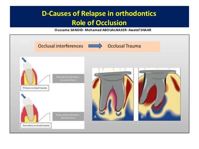 141 relapse in orthodontics-recidives en orthodontie-oussama sandid-m…