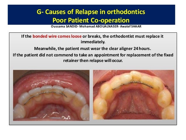 141 relapse in orthodontics-recidives en orthodontie-oussama sandid-m…