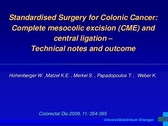 Standardized Surgery for Colonic Cancer - Complete Mesocolic Excision…