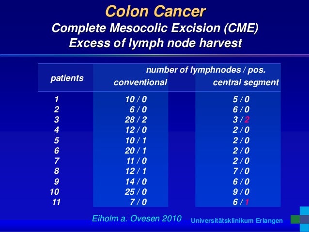 Standardized Surgery for Colonic Cancer - Complete Mesocolic Excision…