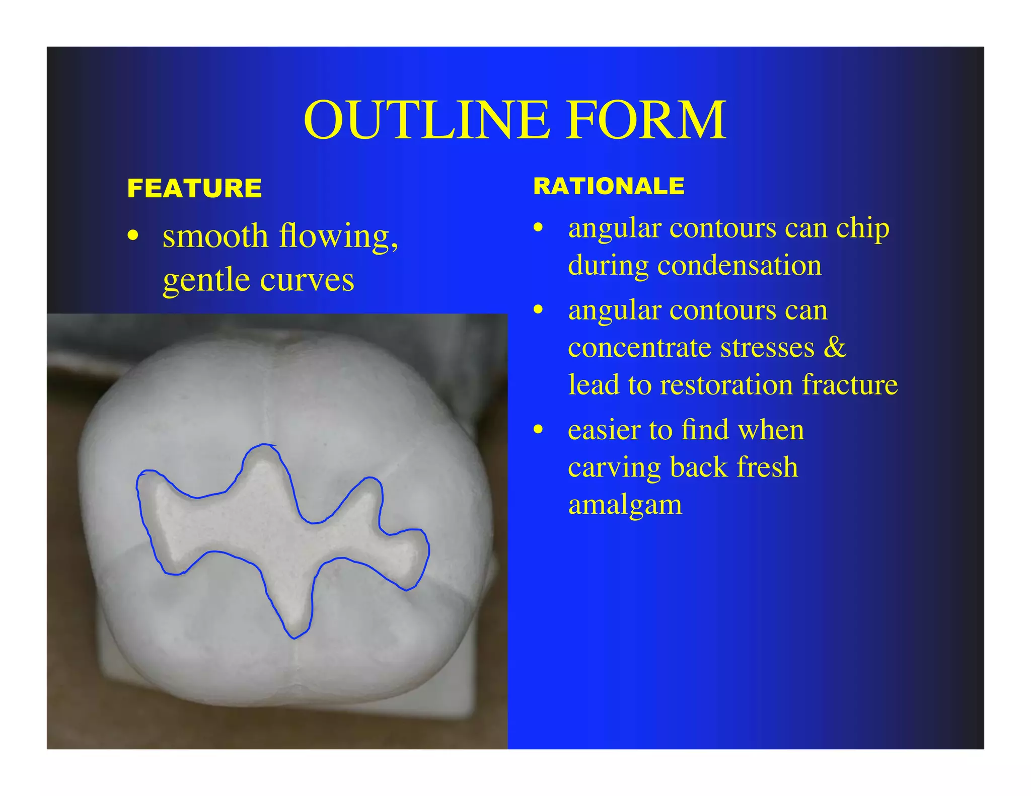 class i amalgam cavity design | PDF