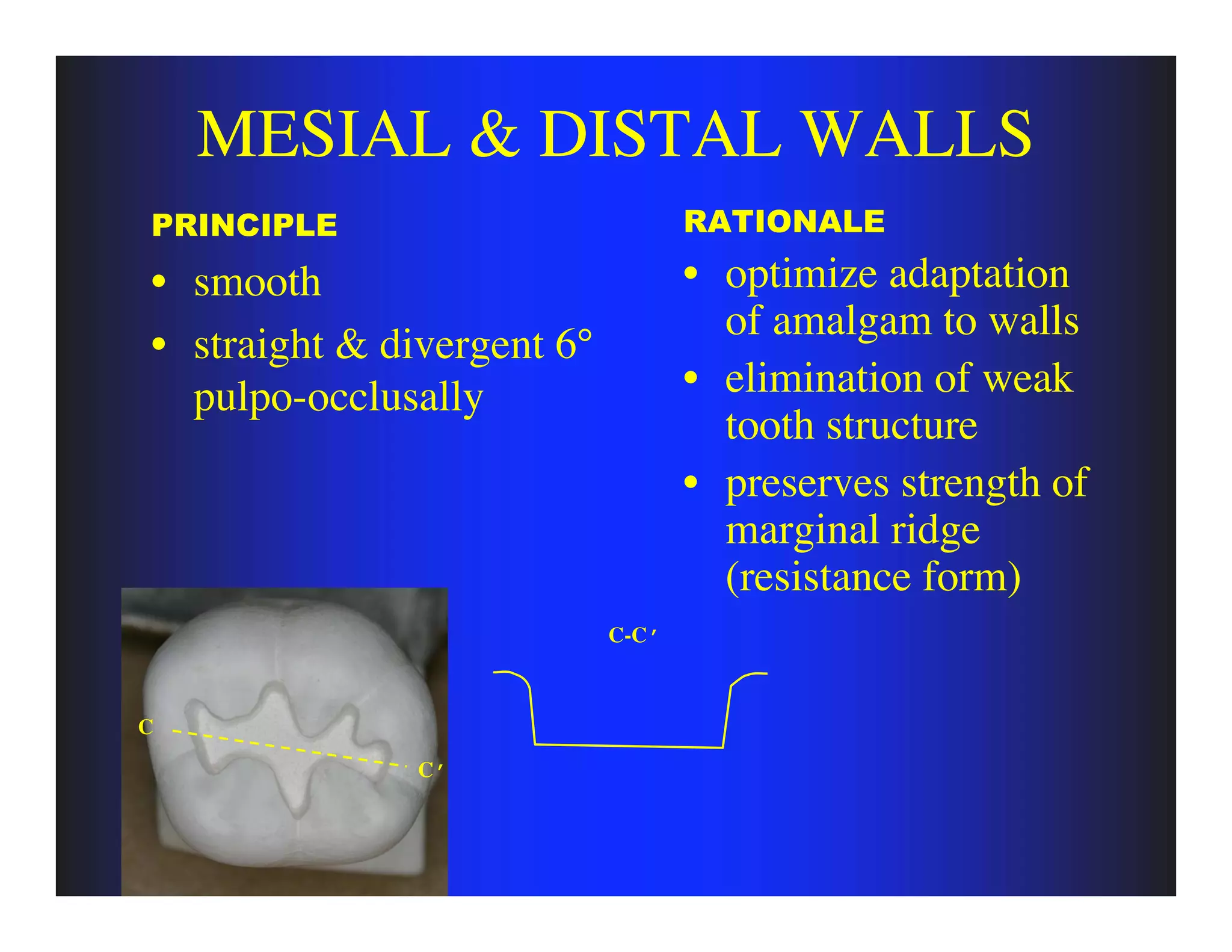 class i amalgam cavity design | PDF