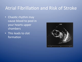 Atrial fibrillation and stroke | PDF